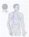 Hernia Nucleus Pulposi (Rughernia) - Osteopathie, Mesologie ...